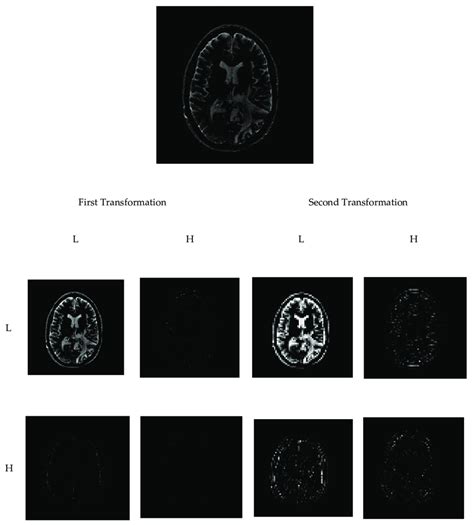 The Sub Bands Of The Wavelet Transformation Using Homomorphic Filtering Download Scientific