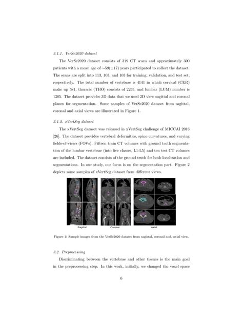 Doubleu Net Architecture With Exploit Multiscale Features For