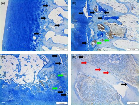 Sex But Not Age And Bone Mass Index Positively Impact On The