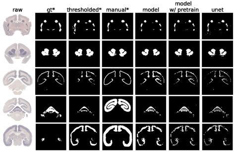 Qualitative Comparison Of Segmentations Humangenerated Segmentations Download Scientific
