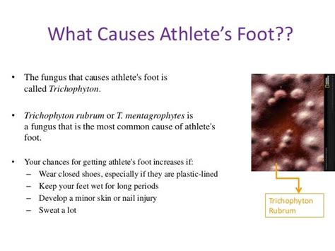 Athletes Foot