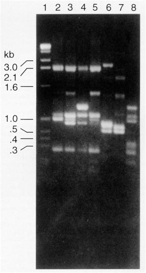 Arbitrarily Primed Polymerase Chain Reaction Of Representative Strains Download Scientific
