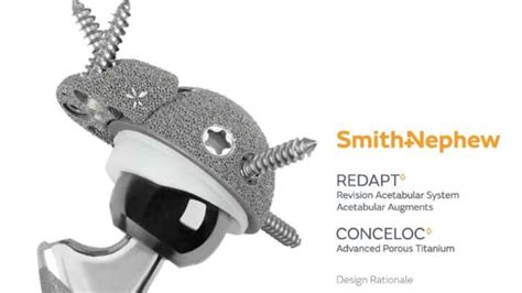 Redapt™ Revision Acetabular Augment Design Rationale Smith And Nephew