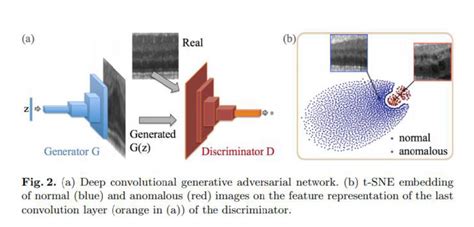Unsupervised Anomaly Detection Using Style Distillation 리뷰