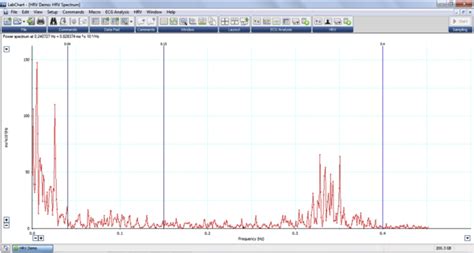Normative Data And Gender Differences In Heart Rate Variability In The Healthy Babe Individuals