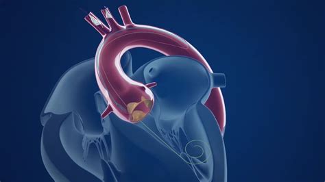 Sarah Grehan Posted On Linkedin