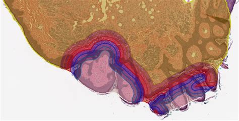 Memory Efficiency When Creating Margin Annotations Image Analysis Image Sc Forum