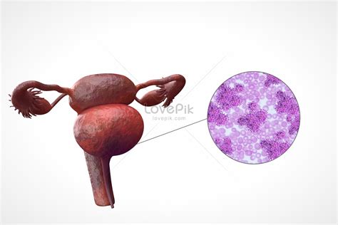 Vaginal Bacterial Infection Creative Image Picture Free Download Lovepik Com