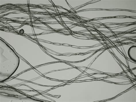 Fact Check Unidentified Particles In Vaccine Samples Under The