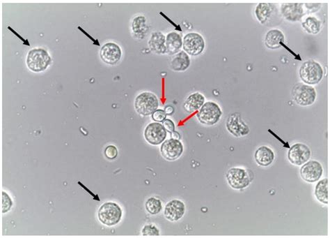 Urine Sediment Findings And The Immune Response To Pathologies In