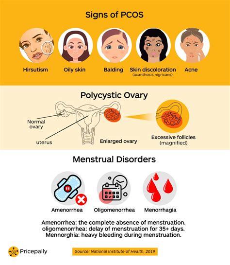 Pcos Diet The Best Food To Manage Pcos In Nigeria Pricepally Blog