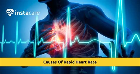 What Are The 5 Main Causes Of Rapid Heart Rate