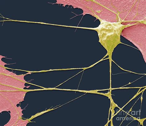Stem Cell Derived Motor Neuron Photograph By Steve Gschmeissnerscience