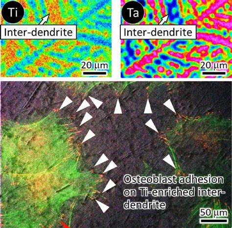 Elemental Segregation And Osteoblast Adhesion Behavior On The Cast