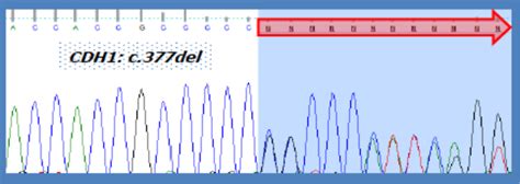 Partial Electropherogram Of Cdh1 Gene Sequencing Hgnc 1748 Lrg 301t1