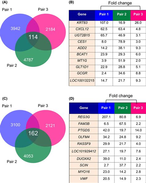 Cdna Microarray Using 3 Resected Intrahepatic Cholangiocarcinoma Frozen