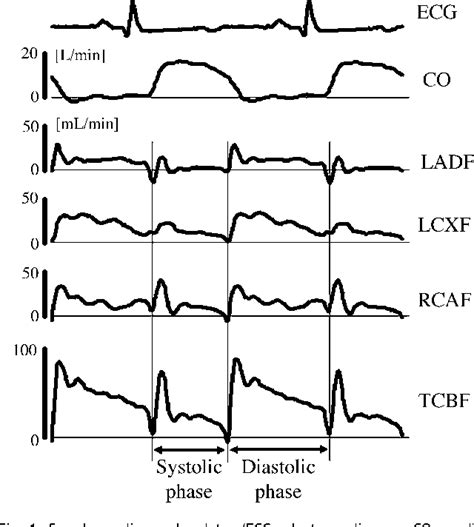 Figure 1 From Phasic Coronary Blood Flow Pattern During A Continuous Flow Left Ventricular