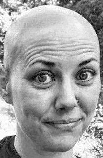 Shaved Head Susan Campbell