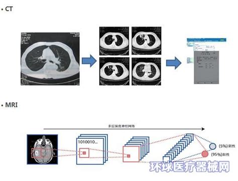 阅片机器人生产厂家 健培 招商代理 环球医疗器械网