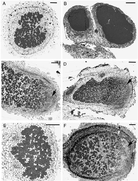 Structure Of The Main Types Of Legume Nodules A Sesbania Macrantha