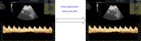 Information — Ultrasound Segmentation Documentation