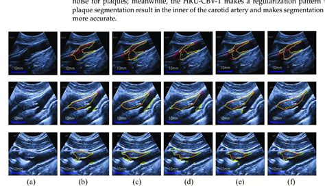 Cbv Effect A Input Images B M Net C U Net D Attention Download Scientific Diagram