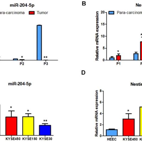 Protein Expression Of Nestin In Escc Tissues And Para Carcinoma