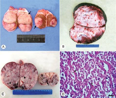 A Multilobular Grayish White Areas At Various Sizes In The Cross