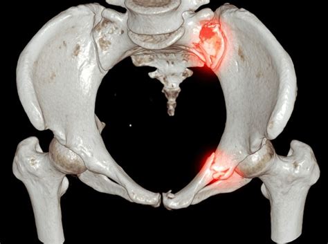 Ct Scan Coccyx Sacrum Royalty Free Images Stock Photos Pictures