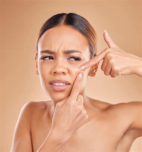 Premium Photo Woman Pop Pimple On Face Acne And Dermatology Skincare And Facial Breakout On