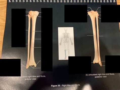 Tibia And Fibula Diagram Quizlet
