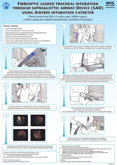 Video Aintree Intubation Technique Openairway