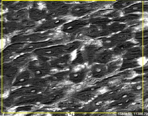 Qupath Quantification Of Cardiomyocyte Size Image Analysis Imagesc