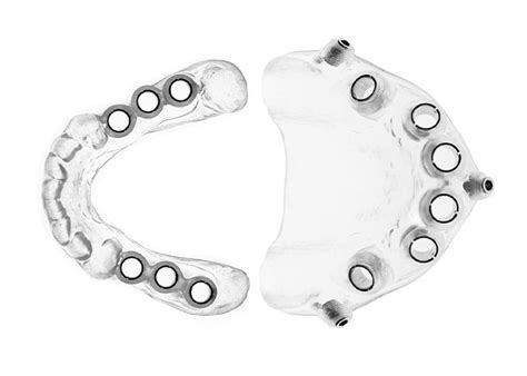 Surgical Guides Digital Scan Lab