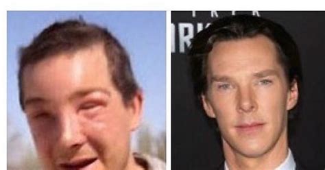 Benadryl Crazypuff Album On Imgur