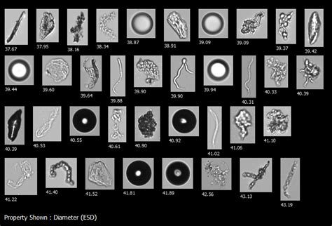 Whats The Value Of Monitoring Silicone Oil Droplets In Protein