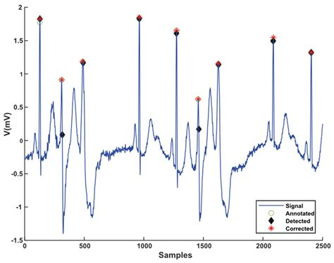 Signal Processing Peak Detection Algorithm At Jenenge Blog
