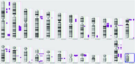 Karyoview Affymetrix Cytoscan ® Hd Array Showing Multiple Rohs