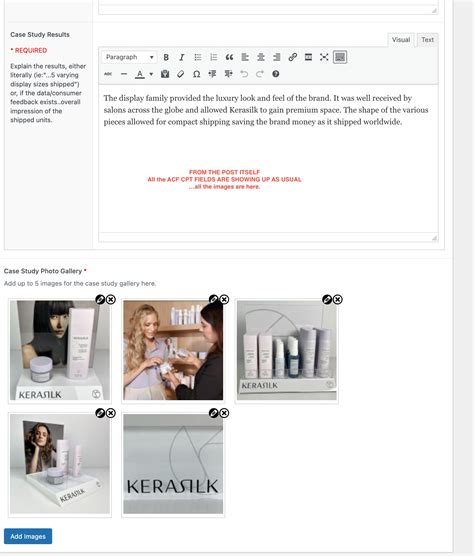 multiple dynamic acf free images in bricks carousel how to bricks