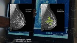 Tecnica Radiologica En La Mamografia Pptx
