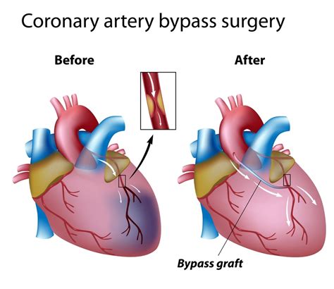 Specialist Cardiac Treatment Dr Nicholas Robinson