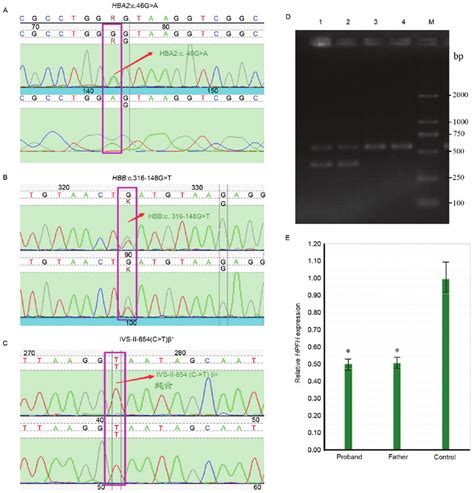 Identification Of Our Mutated Genes In The Proband By DNA Sequencing Download Scientific
