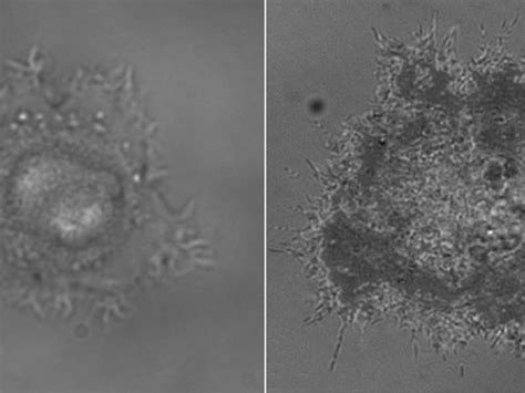 Distinguishing Cancer Cells Using Fractal Geometry Offers Faster Diagnosis