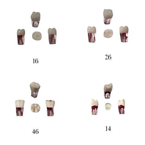 Pack Of 5 Endo Rct Exam Teeth Adc Compatible Moiadcdental