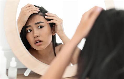 10 Home Remedies To Regrow Hair On Bald Patches Artofit