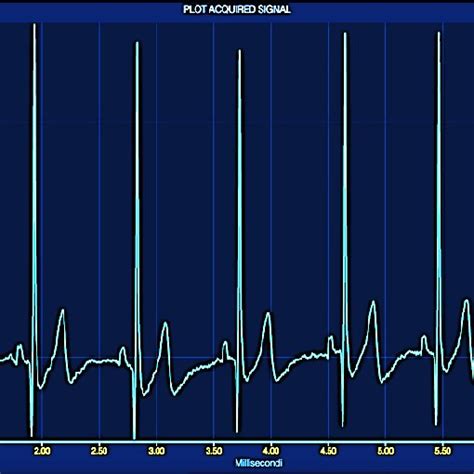 Ecg Remote Visualization Download Scientific Diagram