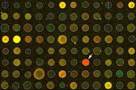 microarray platforms beads slides or chips