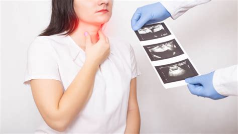 Thyroid Disease Key Information