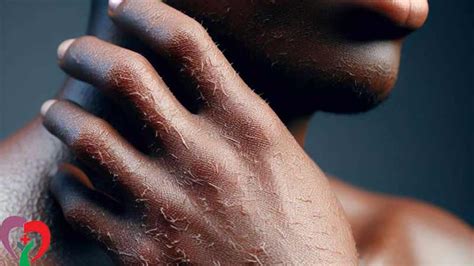 کمبود کدام ویتامین باعث خارش بدن میشه دارو دراگ