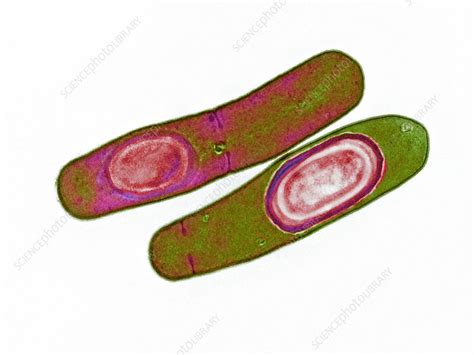 Clostridioides Difficile Bacteria Tem Stock Image B220 1546 Science Photo Library